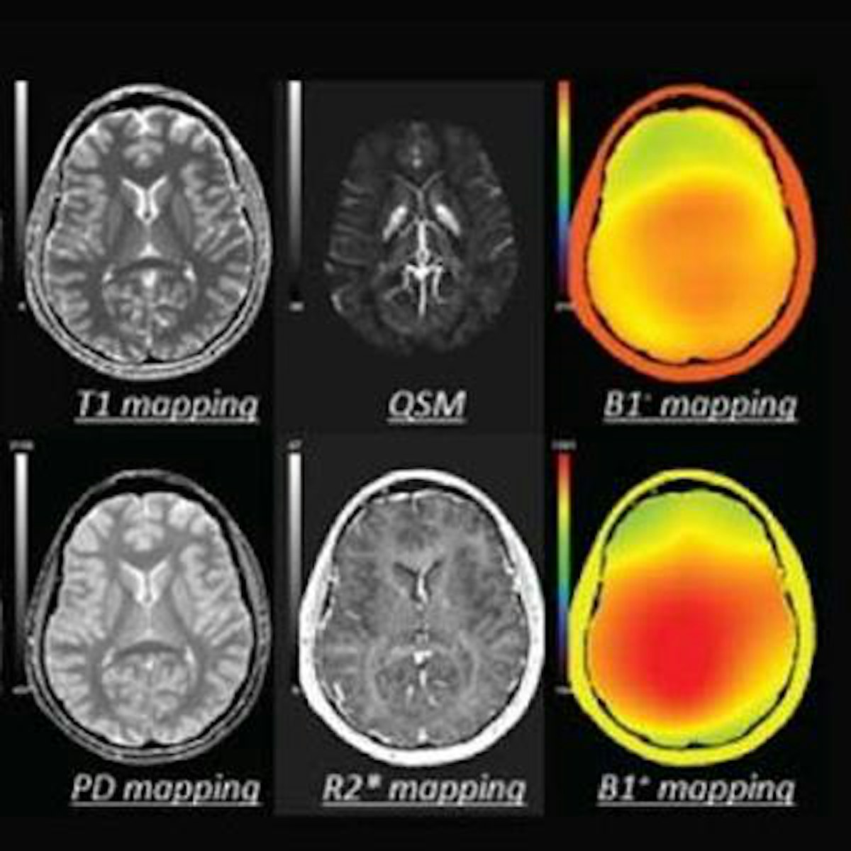 FDA clears SpinTech's newest MRI postprocessing software | AuntMinnie