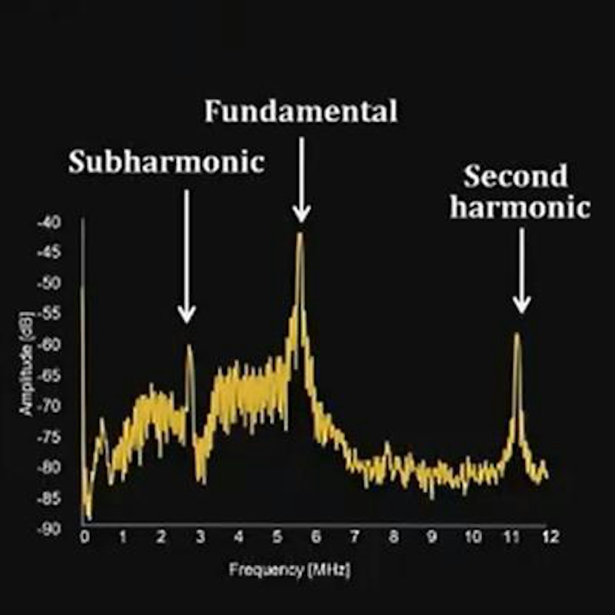 Subharmonic ultrasound better with contrast flow in breast masses ...