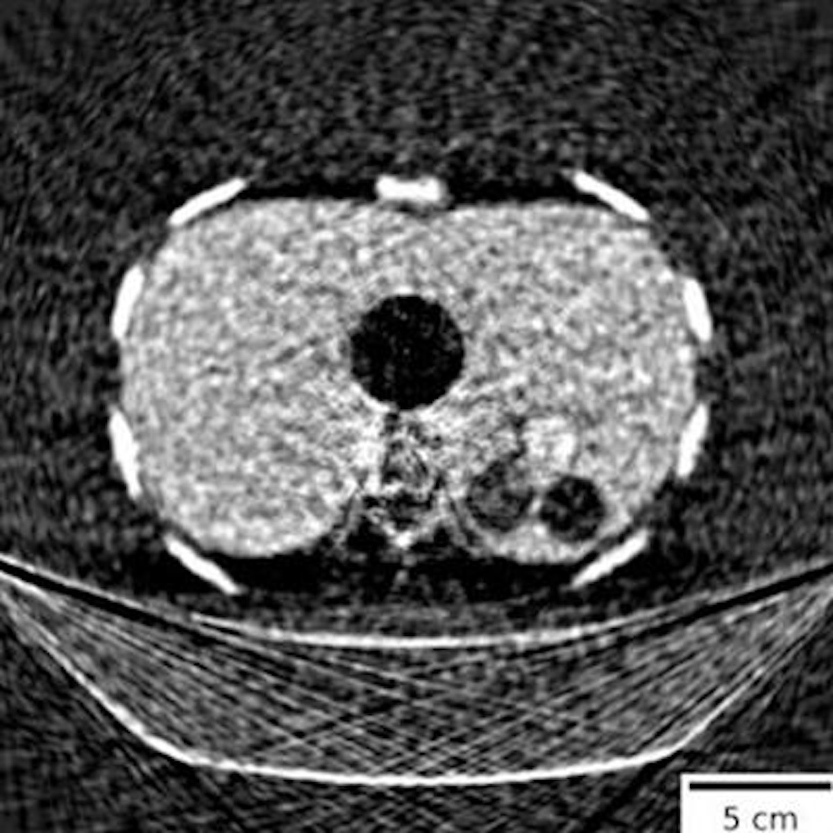 Dark-field CT moves closer to human medical applications | AuntMinnie