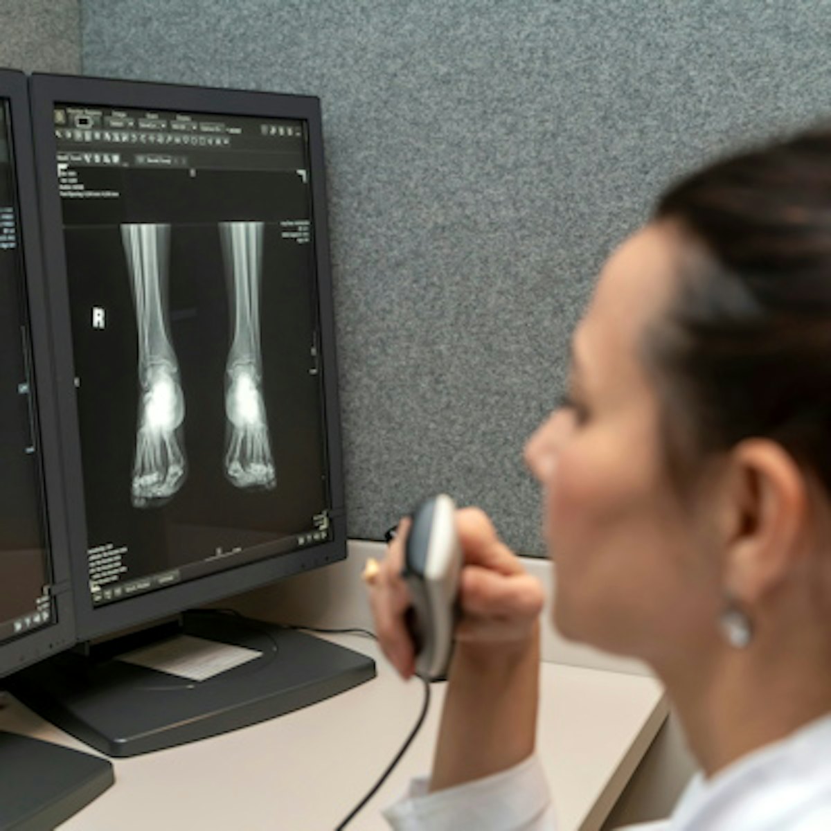 Radiology practices leverage technology to embrace remote reading ...