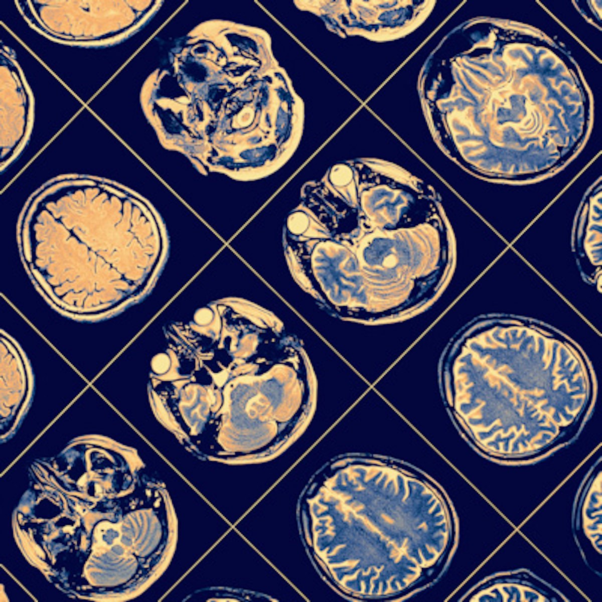 Imaging Biometrics partners with Prism Clinical Imaging | AuntMinnie