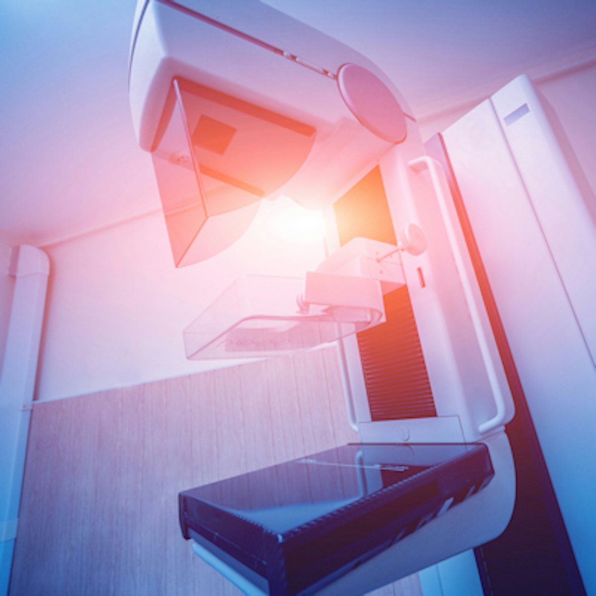 AI system may help with mammographic breast positioning | AuntMinnie