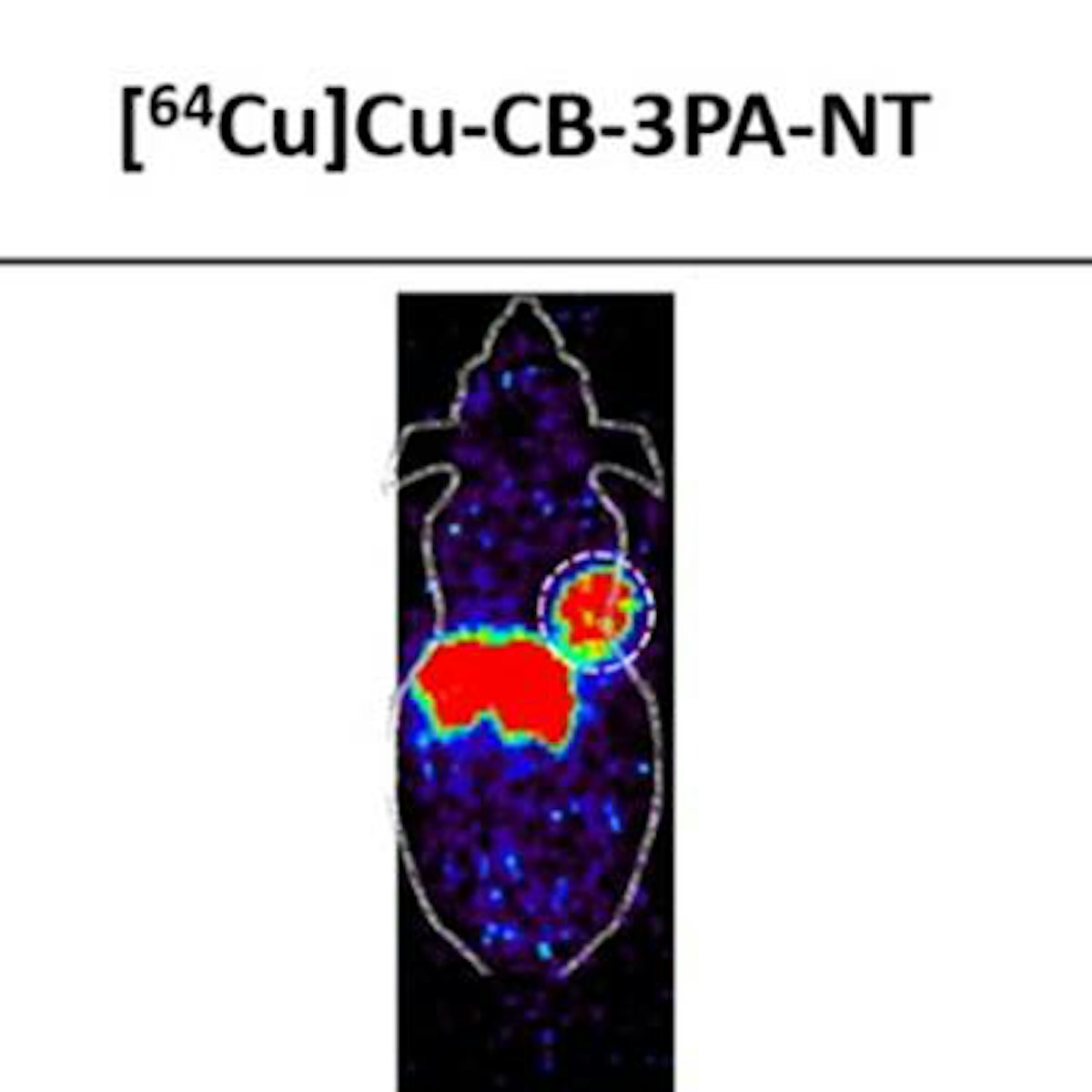 SNMMI: Theranostics method targets multiple cancers | AuntMinnie