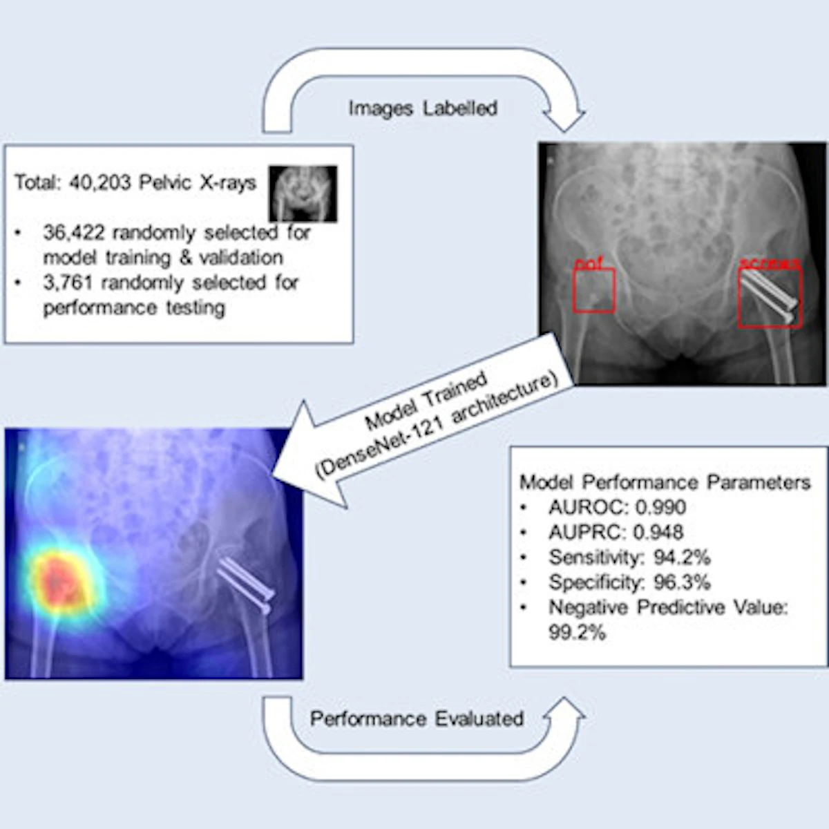 AI detects hip fractures on x-rays | AuntMinnie