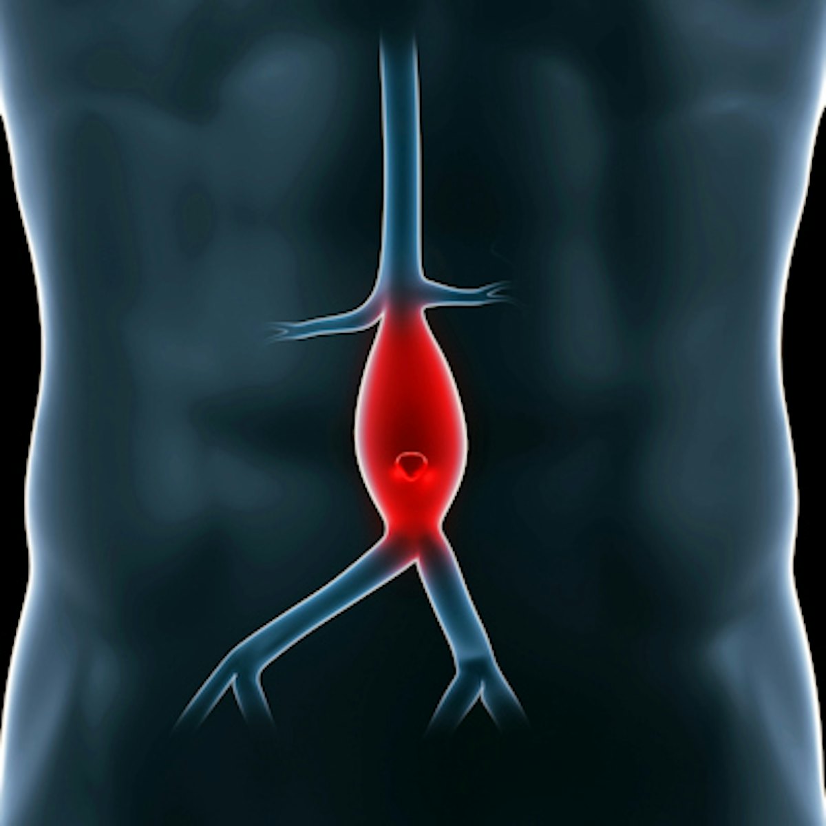 Astute Imaging enters into agreement with Nectero | AuntMinnie