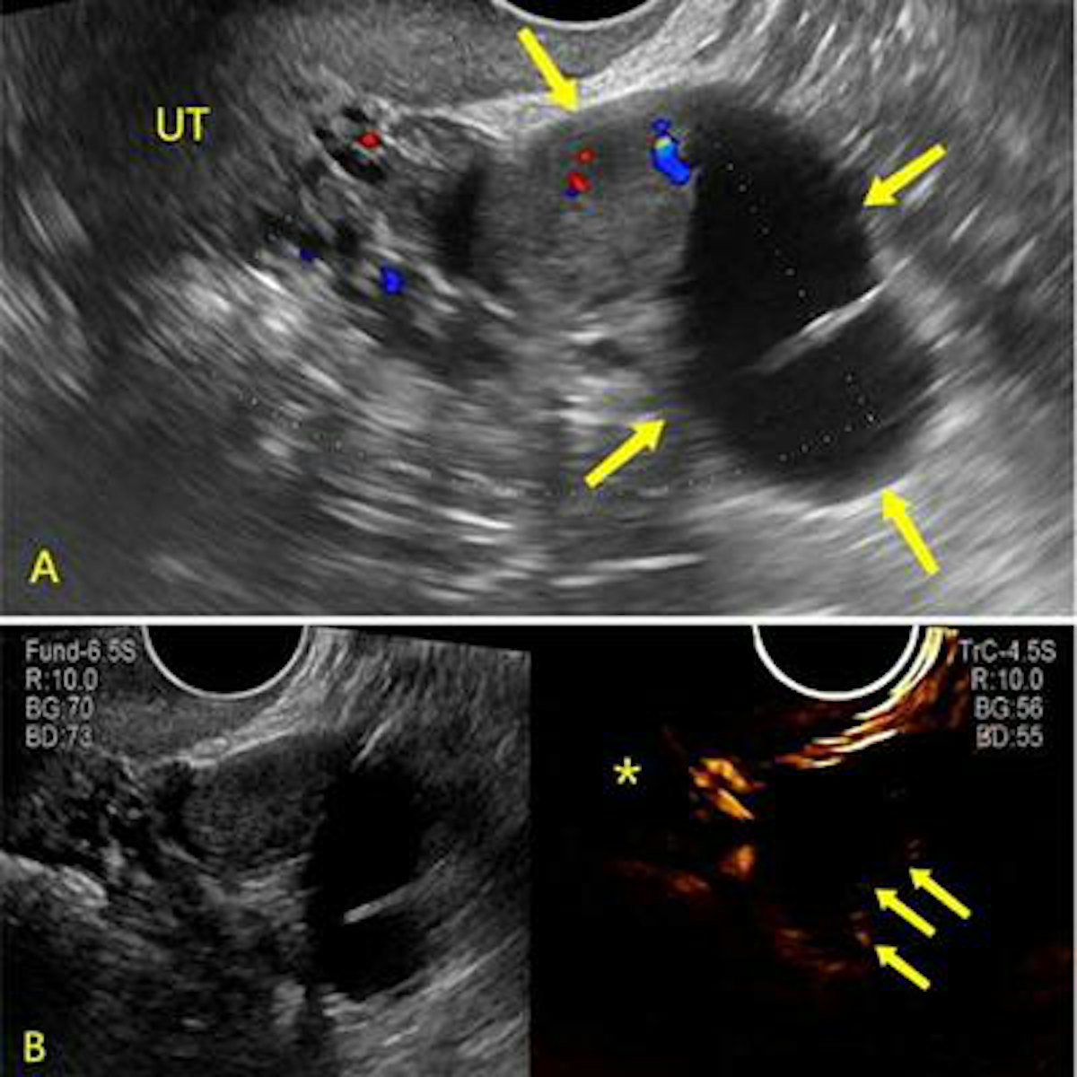 CEUS improves O-RADS diagnostic performance | AuntMinnie