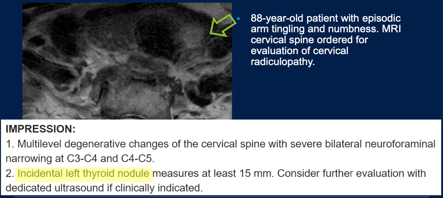Closing the loop on incidental imaging findings | AuntMinnie