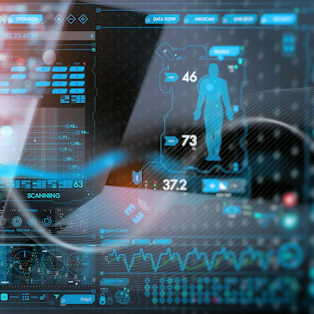 Rad AI demos updates to its radiology reporting system at RSNA | AuntMinnie