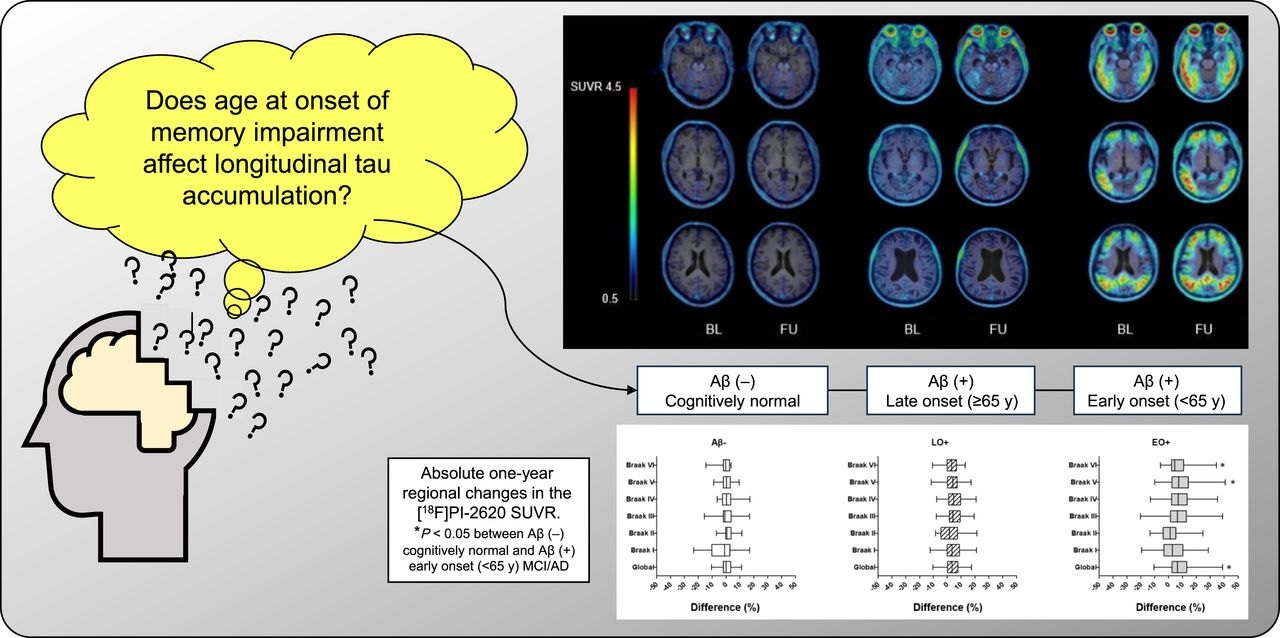 New tau PET tracer shows promise in Alzheimer’s disease patients ...
