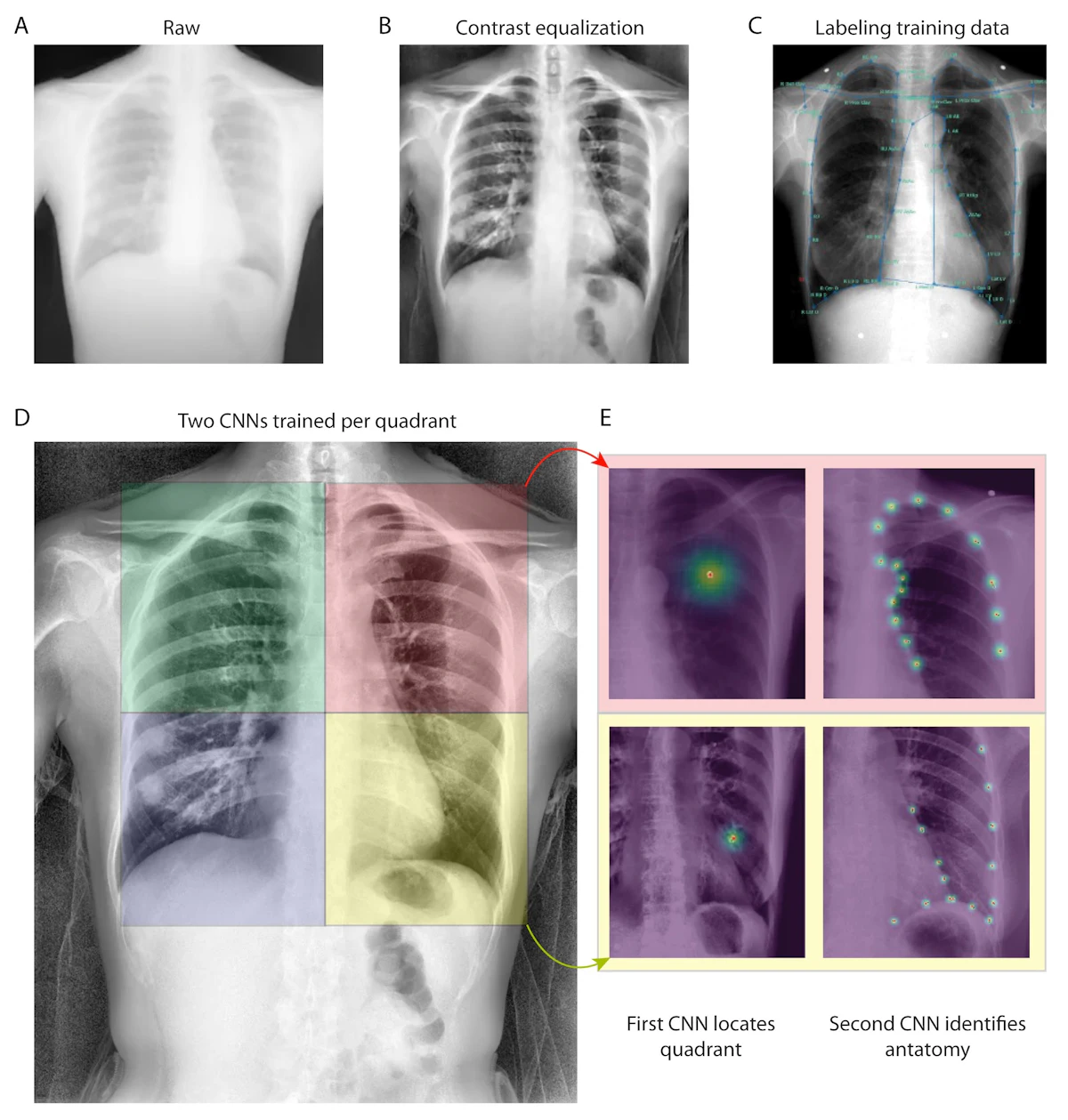 Can AI help chest DDR achieve clinical adoption? | AuntMinnie