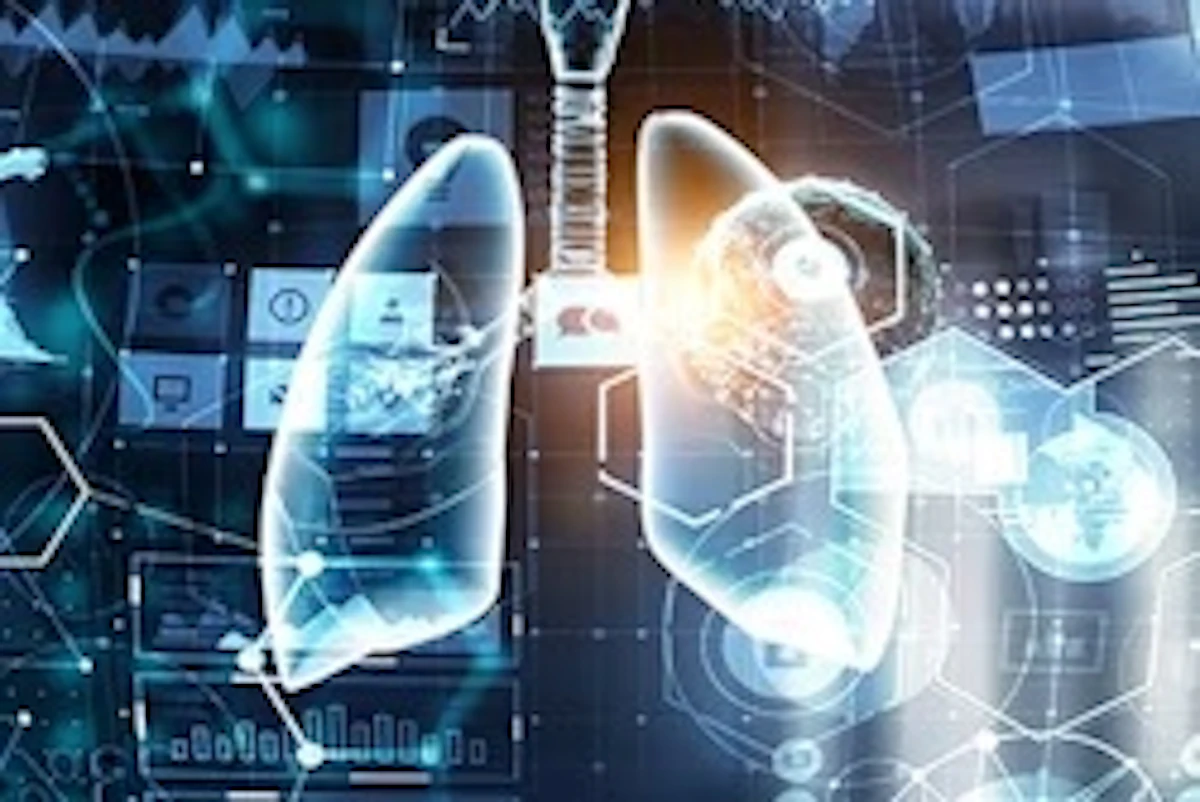 AI model predicts invasiveness of lung cancer on CT scans | AuntMinnie