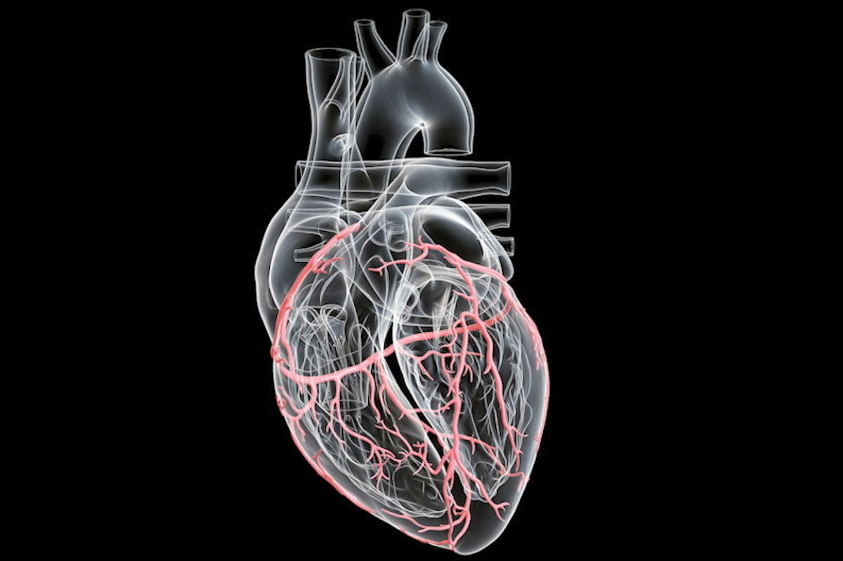 How AI has improved CT image reconstruction for cardiac cases | AuntMinnie