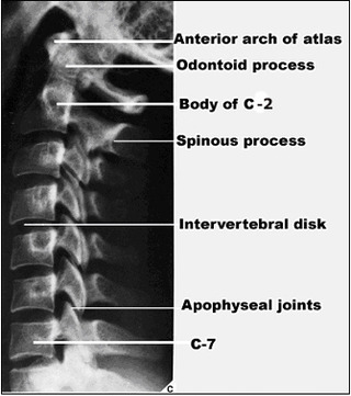 Radiographic positioning techniques for the cervical spine | AuntMinnie