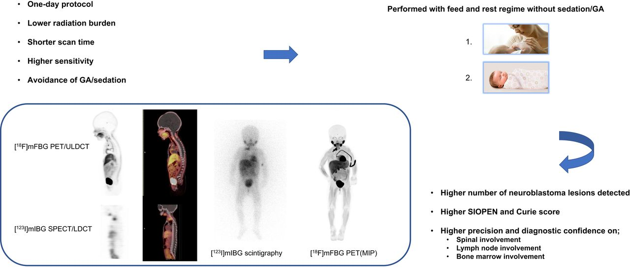LAFOV PET/CT feasible in infants with neuroblastoma | AuntMinnie