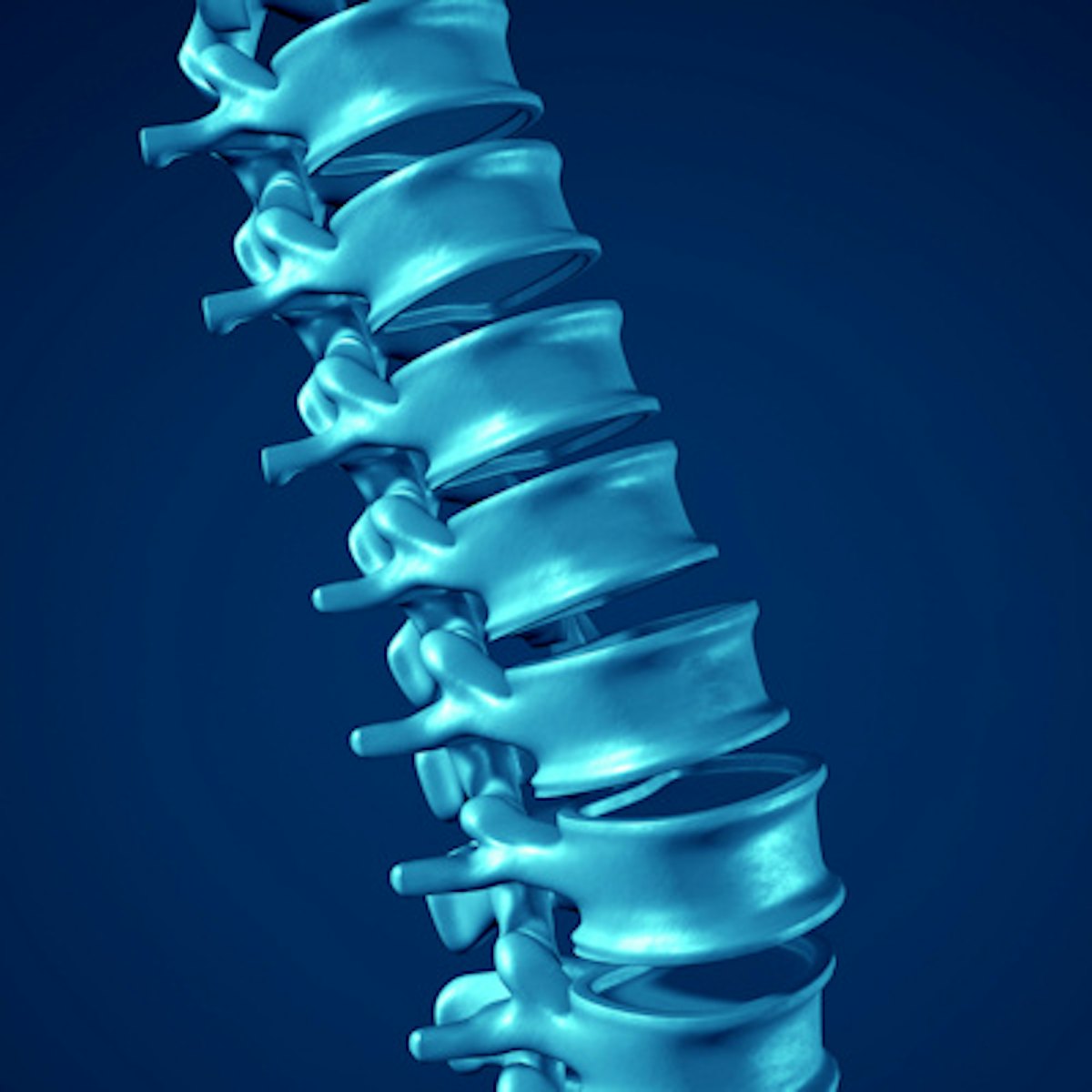 RSNA names winners of lumbar spine AI challenge | AuntMinnie