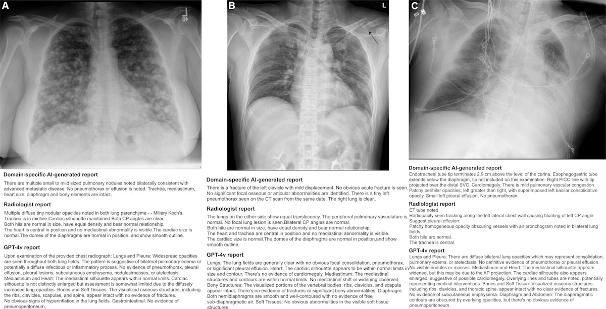 chest xray normal report