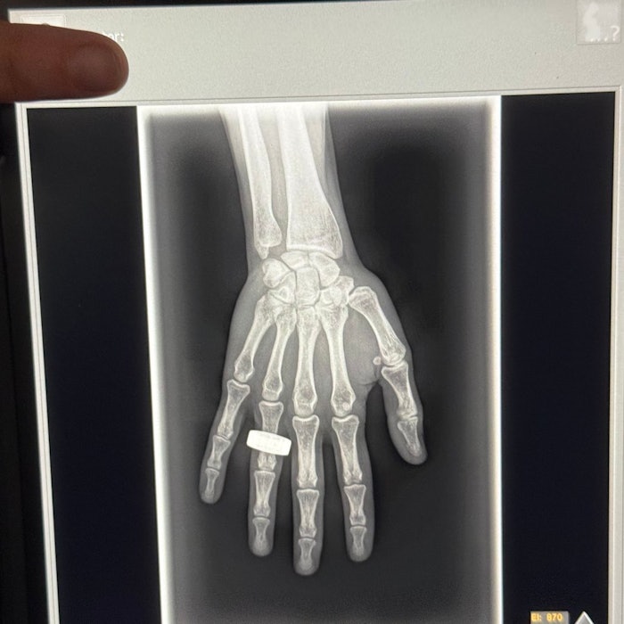 Fram2: The first X-ray image taken in space – Behind The Black – Robert ...