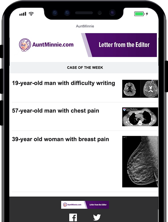 Will new CPT code drive utilization of quantitative MRI? | AuntMinnie