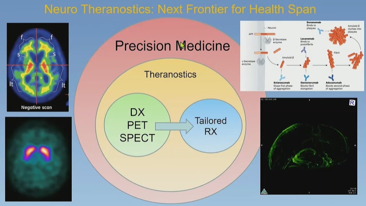 Brain theranostics may be new frontier for nuclear medicine | AuntMinnie
