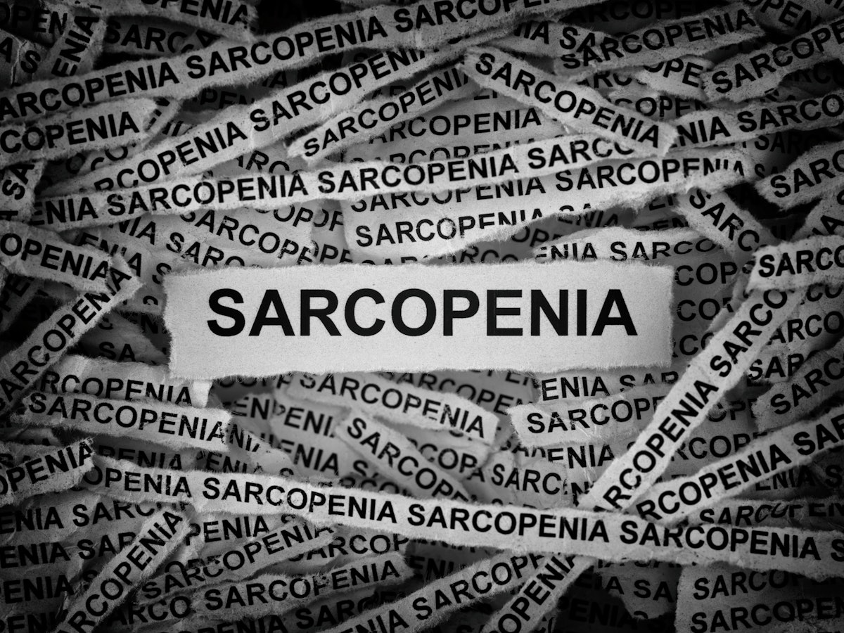 Abdominal CT imaging shows potential for diagnosing sarcopenia | AuntMinnie