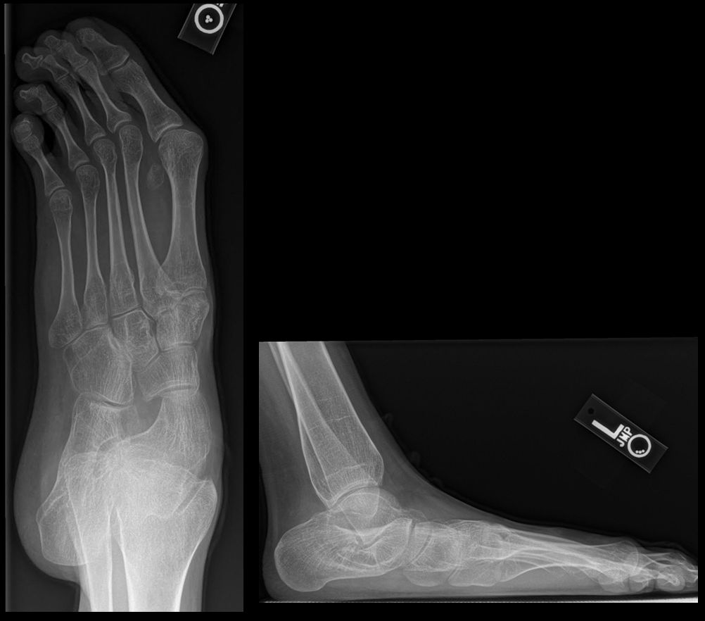Imaging findings of Marfan syndrome: What radiologists need to know ...