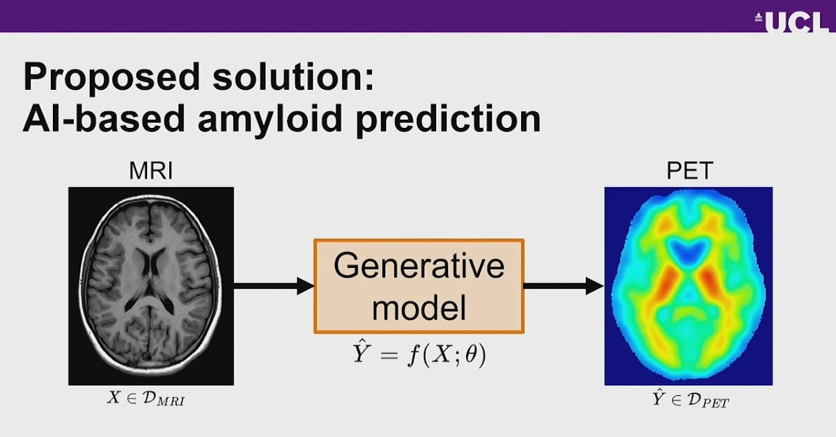 ISMRM: Barriers face synthetic amyloid PET image development | AuntMinnie
