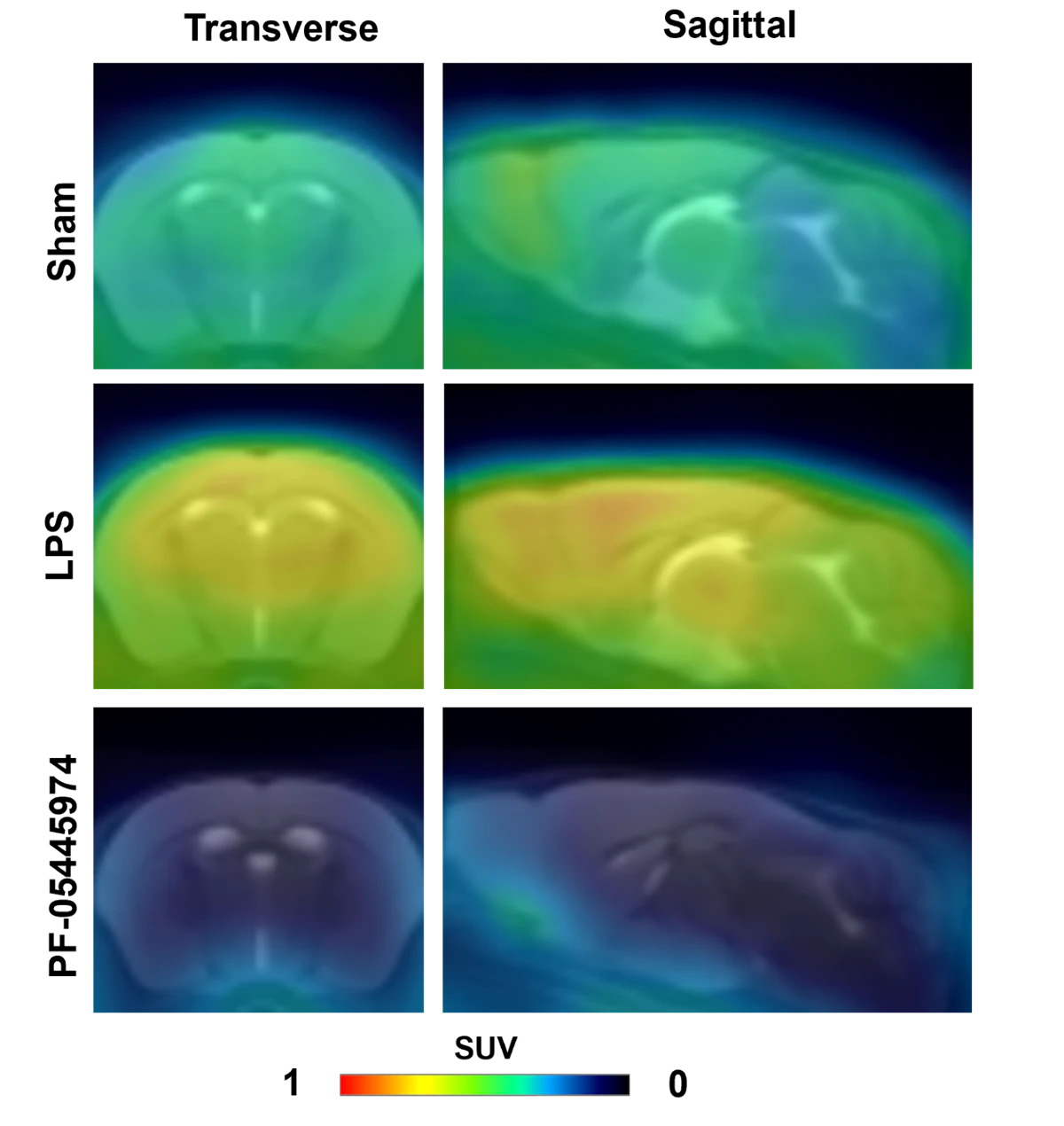 SNMMI: PET tracer images brain inflammation | AuntMinnie