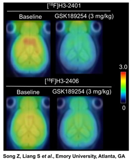 SNMMI: New PET tracers developed for imaging brain disorders | AuntMinnie