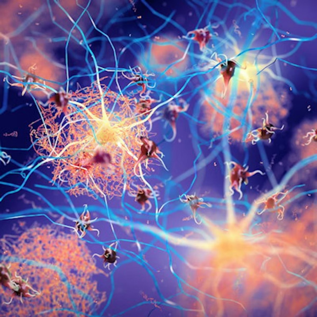 Visual reads of amyloid PET scans effective in real-world settings ...