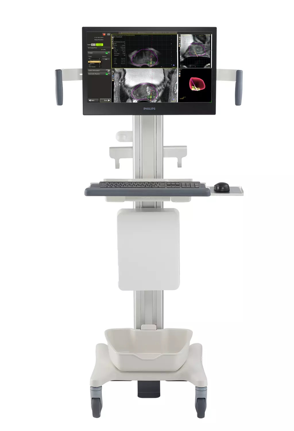 Philips secures FDA clearance for latest UroNav system | AuntMinnie