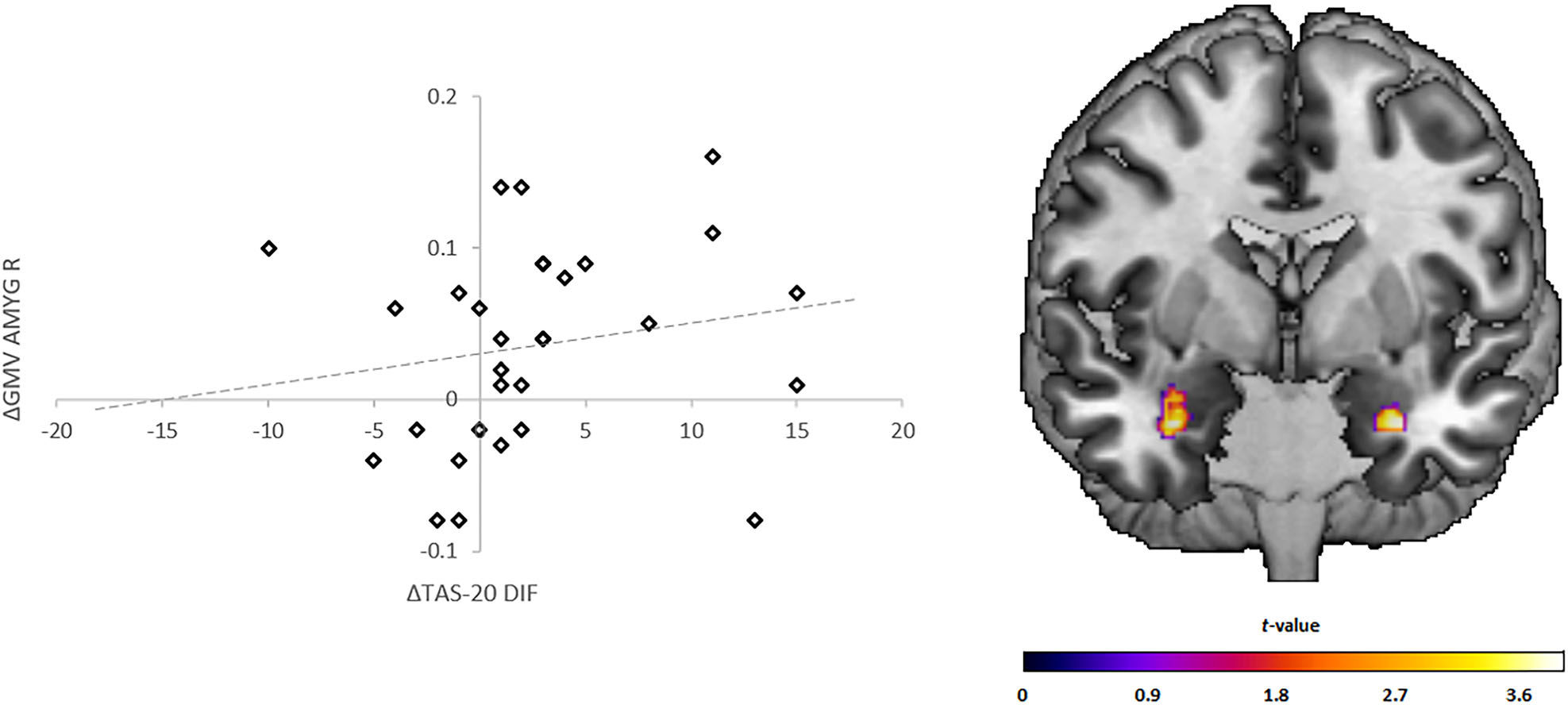 fMRI: Cognitive behavioral therapy positively affects the brain ...
