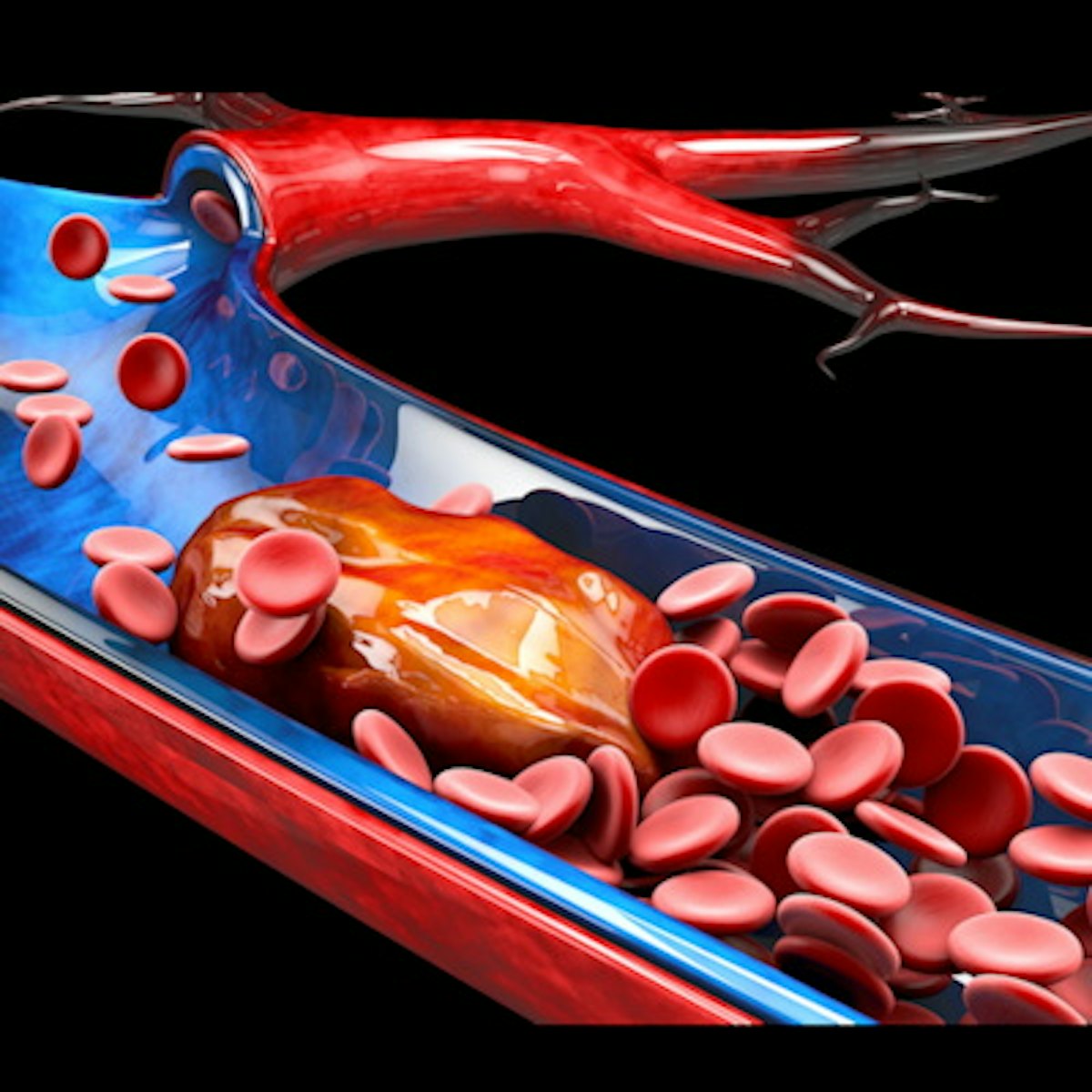 Gentuity, GE HealthCare collaborate on intravascular imaging platform ...