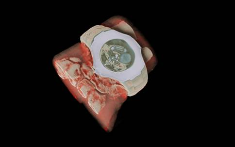 MARS Bioimaging advances Series A round for color CT imaging system ...