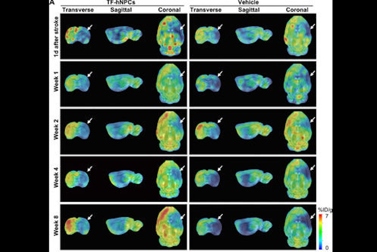 Coming soon? 'Regenerative imaging' | AuntMinnie