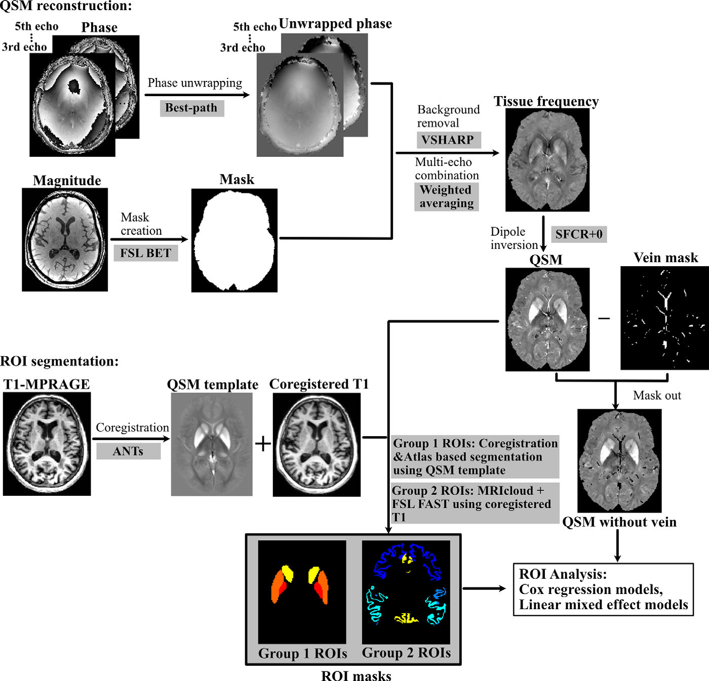 Brain iron findings on MRI help predict cognitive decline | AuntMinnie