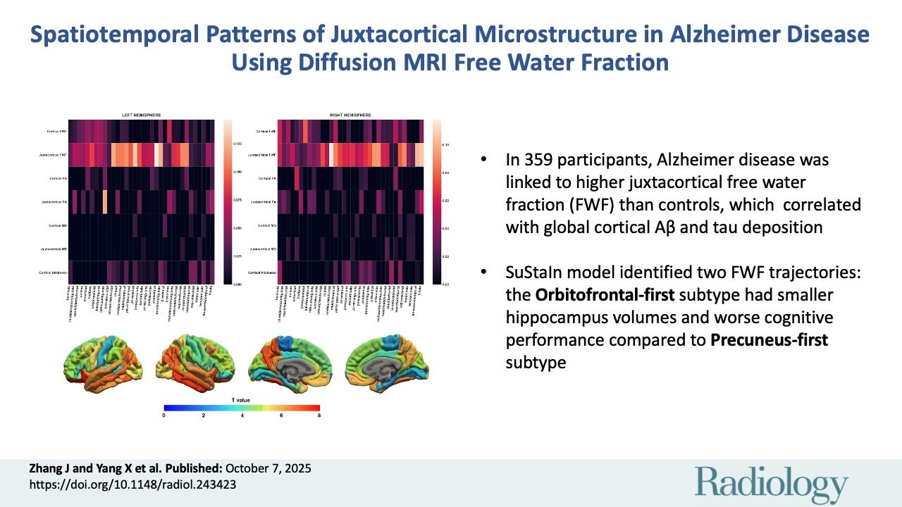 Diffusion MRI reveals new pattern underlying Alzheimer’s disease ...