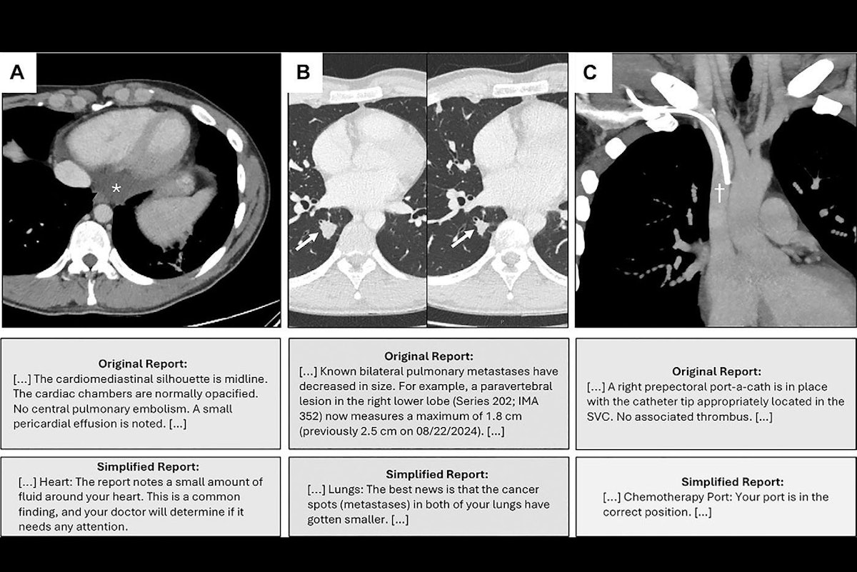 LLMs improve patient comprehension of oncologic CT reports | AuntMinnie