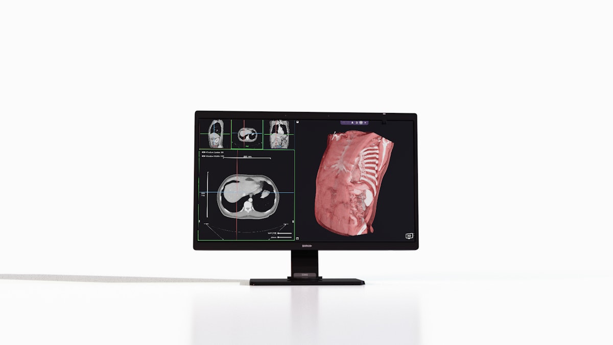 Avatar Medical, Barco launch Eonis Vision | AuntMinnie