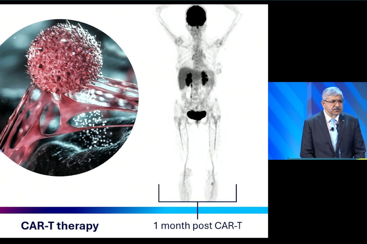 Molecular imaging will advance next revolution in radiology | AuntMinnie