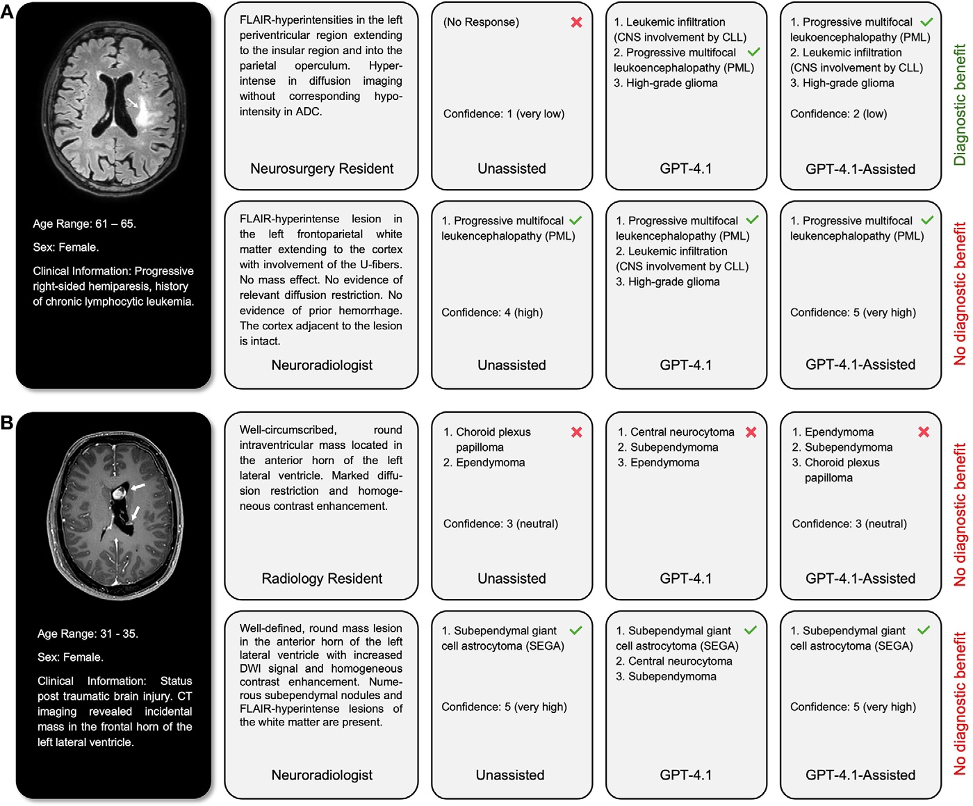 AI diagnostic aid helps novice MRI readers, but experts not so much ...